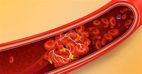 Renae Wright Dnp Rn Cnor Ebp C Posted On Linkedin