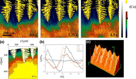 X Ray Radiographs Showing Planar Eutectic And Columnar Dendritic Growth Download Scientific