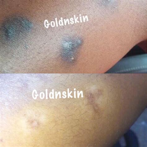 Pin On Skin Whitening Skin Brightening Skin Toning