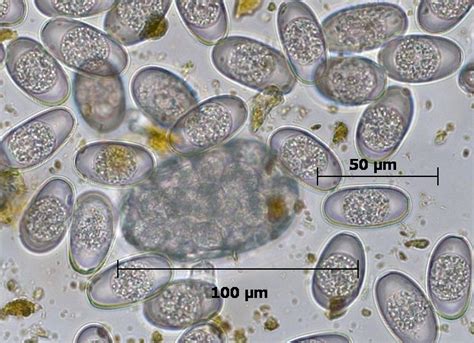Eimeria Sp Fecal Flotation From A Rabbit Features To Note Are The Eimeria Sp Fecal Flotation From A Rabbit Features To Note Are The