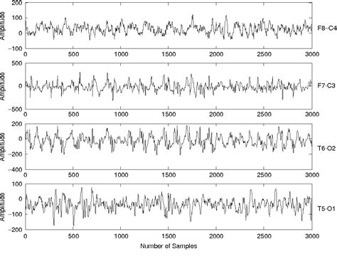 Figure 1 From Wavelet Neural Network Classification Of Eeg Signals By