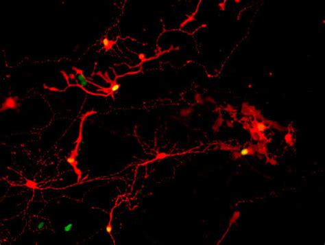 Lab Grown Retinal Eye Cells Make Successful Connections Open Door For Clinical Trials To Treat