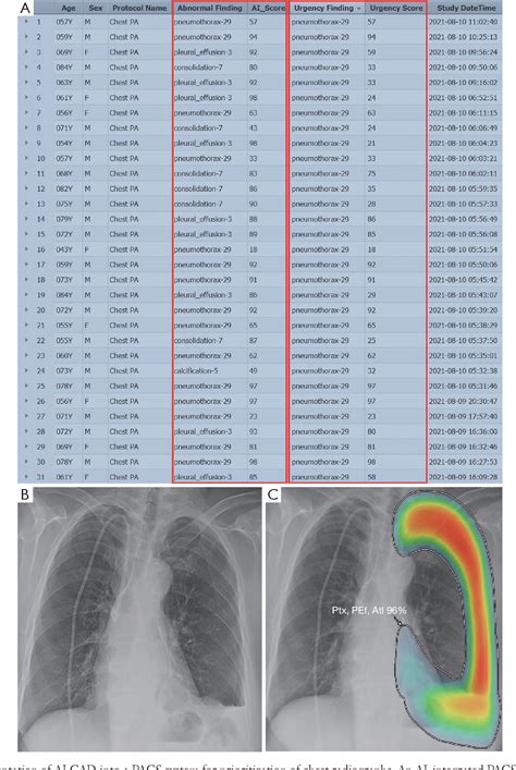 Figure 1 From Applications Of Artificial Intelligence In The Thorax A Narrative Review Focusing