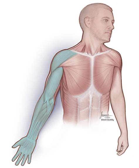 Supraclavicular Block Techniquespinal Of The Arm