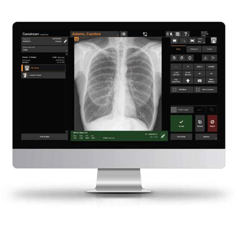 ImageView Software BMI