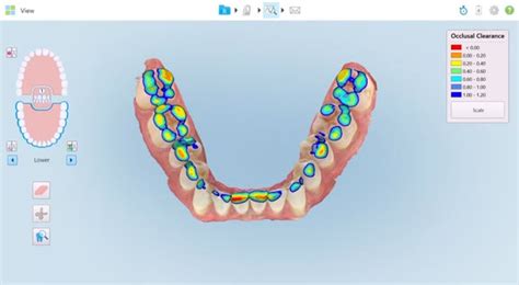 ITeroEd ITero Applications