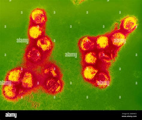 False Colour Transmission Electron Micrograph Of Tick Borne