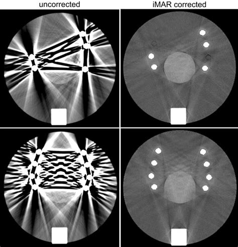Uncorrected Left And Imar Corrected Right Ct Data Of The Phantom Download Scientific