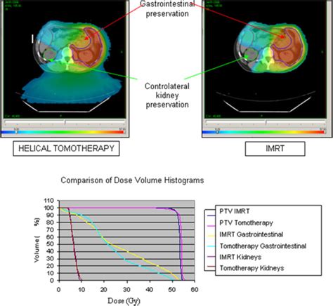 Dosimetric Comparison Between Tomotherapy And Intensity Modulated
