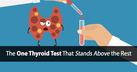 Thyroid Tests Why They Are Almost All Unreliable