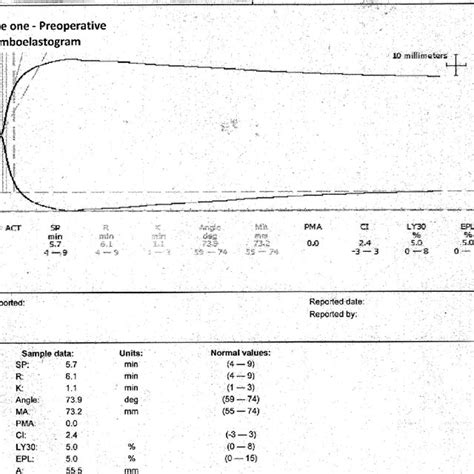Postbypass Thromboelastogram Download Scientific Diagram