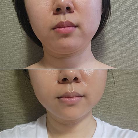 울산 남구 삼산 피부관리 잘하는 집 뷰티앤슬림 네이버 블로그