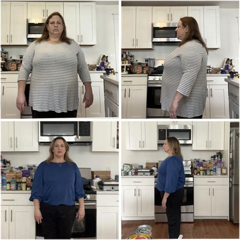 Ozempic Before And After Dozens Of Inspiring Weight Loss Success