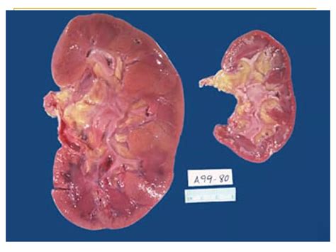 Dr Prashanth Jain Basic Pathology Ppt