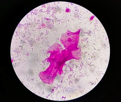 Trichomonas Vaginalis Gram Stain