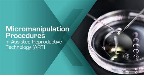 Micromanipulation Procedures In Assisted Reproductive Technology Art