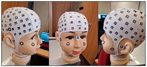 Craniofacial 3d Morphometric Analysis With Smartphone Based Photogrammetry