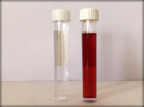 Colloidal Solution Of Lithium Nitrate Nps With Hibiscus Sabdariffa L Download Scientific