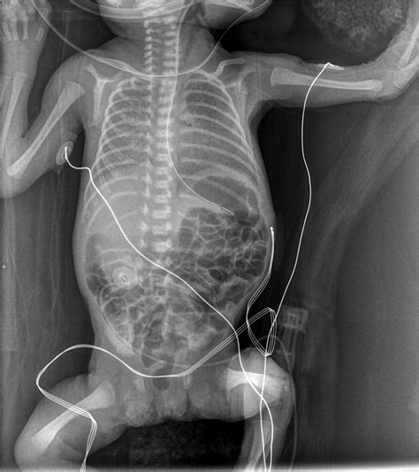 Neonatal Imaging Buyxraysonline