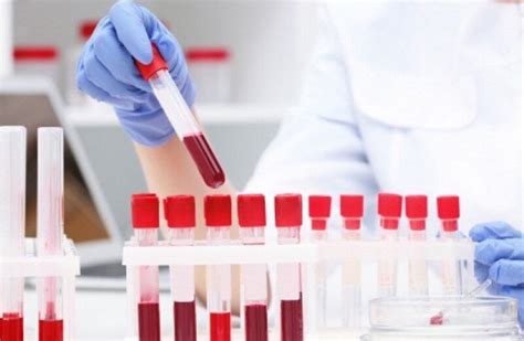 Урьдчилан сэргийлэх эрт илрүүлэг үзлэг шинжилгээнд 800 гаруй мянган хүнийг хамруулжээ E Mn