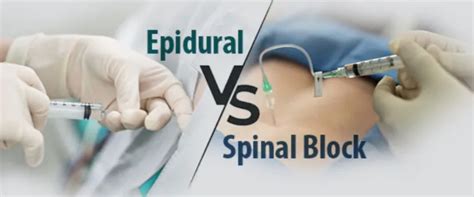 Spinal Block Versus Epidural Block