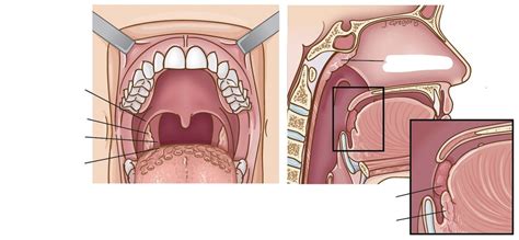 Anterior Tonsillar Pillar
