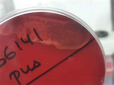Staphylococcus Epidermidis Introduction Morphology Pathogen