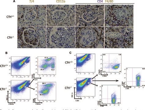 Figure 1 From Complement Factor H Deficiency Accelerates Development Of