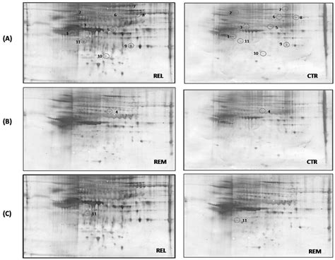 Oxidized Protein Detection By Redox Proteomics Proteomic Profile Of