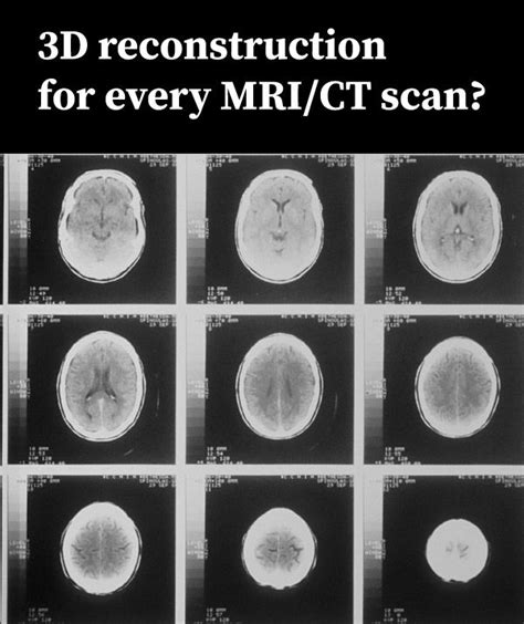 Mri Images With The Words 3d Reconstruction For Every Mri Ct Scan In Black And White