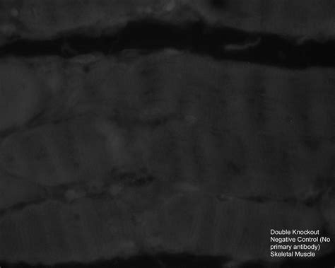 how do you normalize images with different background fluorescence with