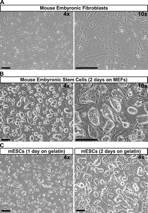 Differentiation Of Mouse Embryonic Stem Cells Into Cortical Interneuron Precursors Protocol