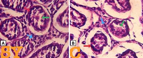Effect Of Dietary Selenium Yeast Supplementation On Morphology And Antioxidant Status In Testes