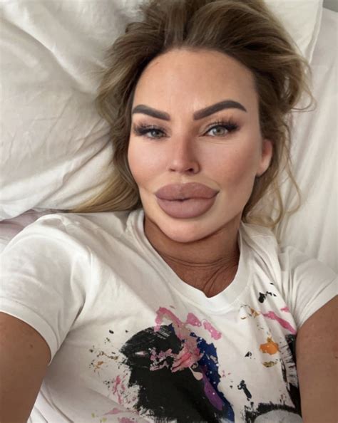 Magdalena Graafs Chockbilder Ett Kilo Silikon Från Turkiet