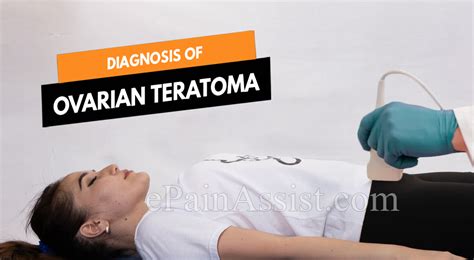 What Is Ovarian Teratoma And How Is It Treated Types Causes Symptoms