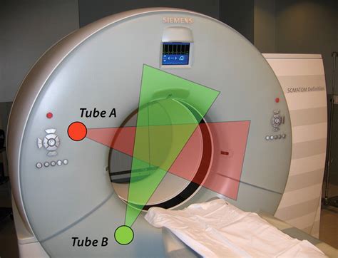 Dual Energy Ct As A Potential New Diagnostic Tool In The Management Of Gout In The Acute Setting