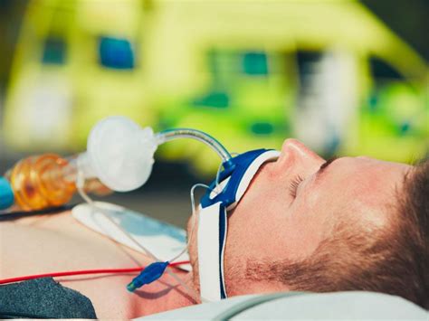 Endotracheal Intubation Purpose Procedure And Risks