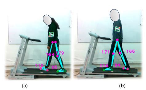 Development Of A Low Cost Markerless Optical Motion Capture System For Gait Analysis And