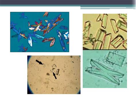 Шээсний тундасын шинжилгээ Pptx