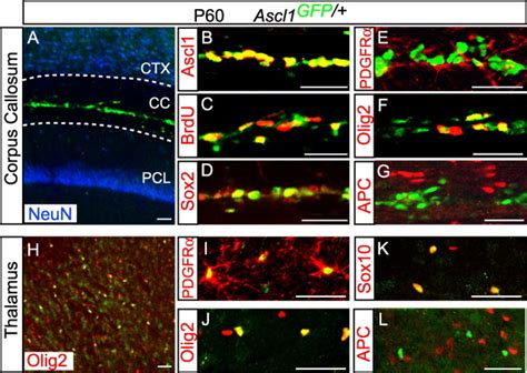 In Vivo Analysis Of Ascl1 Defined Progenitors Reveals Distinct Developmental Dynamics During