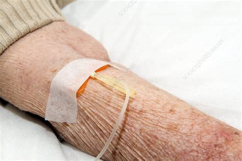 Privigin Infusion Stock Image C0199542 Science Photo Library