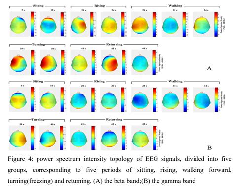 Time Frequency Analysis Of Gait Eeg Signals For Freezing Of Gait In A Pd Patient Mds Abstracts