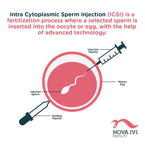 Nova Ivf Fertility On Linkedin Intra Cytoplasmic Sperm Injection Or
