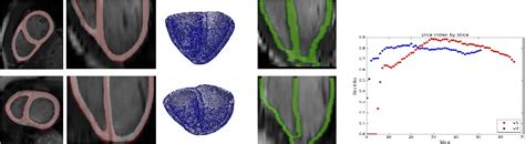 3d consistent biventricular myocardial segmentation using deep learning