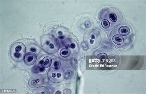 Cyanobacteria Micrograph Photos And Premium High Res Pictures Getty