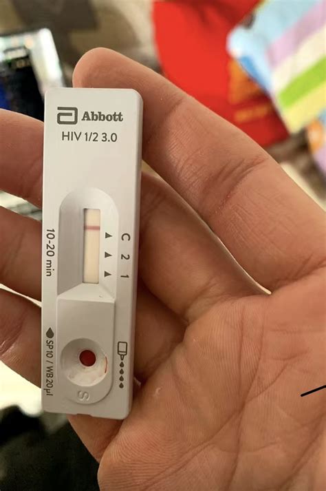 Alere Abbott Hiv 1 2 Test