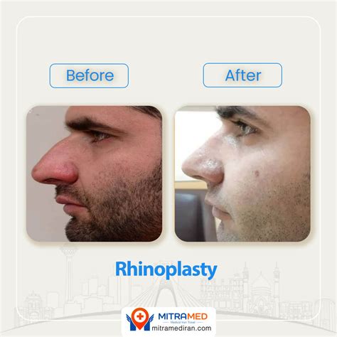 Dr Nasrin Yazdani Mitramed