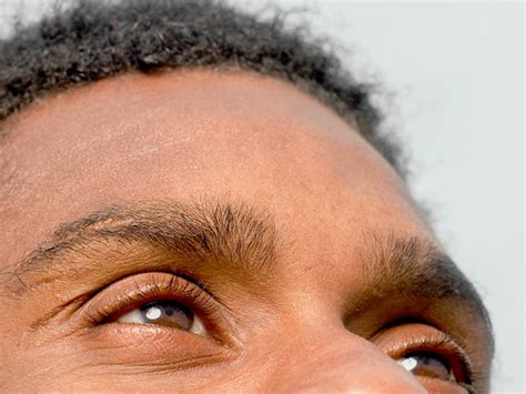 Dry Eye Or Allergies Differences Causes Treatment