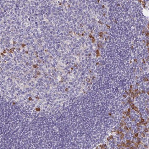 Rabbit Polyclonal Anti Bad Antibody Buy For Research Highly Specific Rigorously Validated