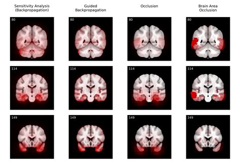 Alternatives And Detailed Information Of Cnn Interpretability Gitplanet